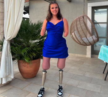 Isabelle Weall’s story: thriving as a quadruple amputee - Meningitis ...