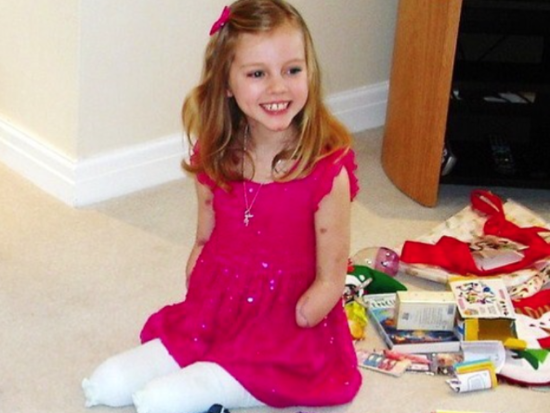 Isabelle Weall’s story: thriving as a quadruple amputee - Meningitis ...